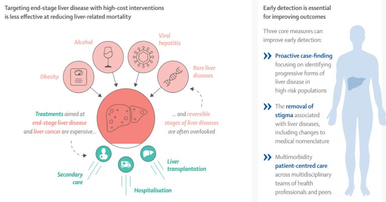 Launching the second EASL-Lancet Commission on liver health in Europe ...